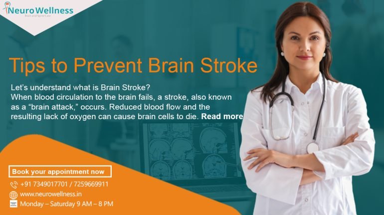 Prevent Brain Stroke | Tips from Neurologists Bangalore