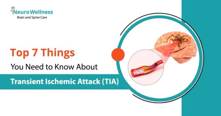7 Key Facts About Transient Ischemic Attack (TIA)