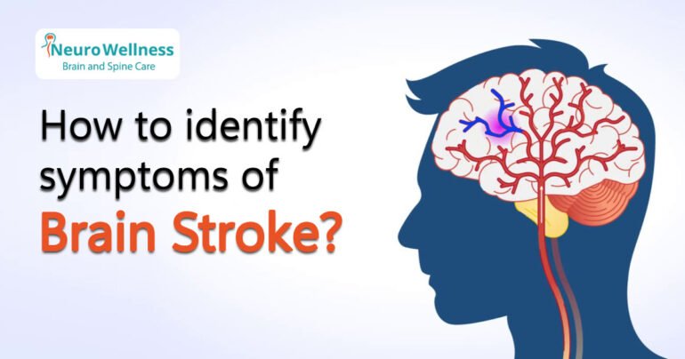 How to identify warning signs of stroke!